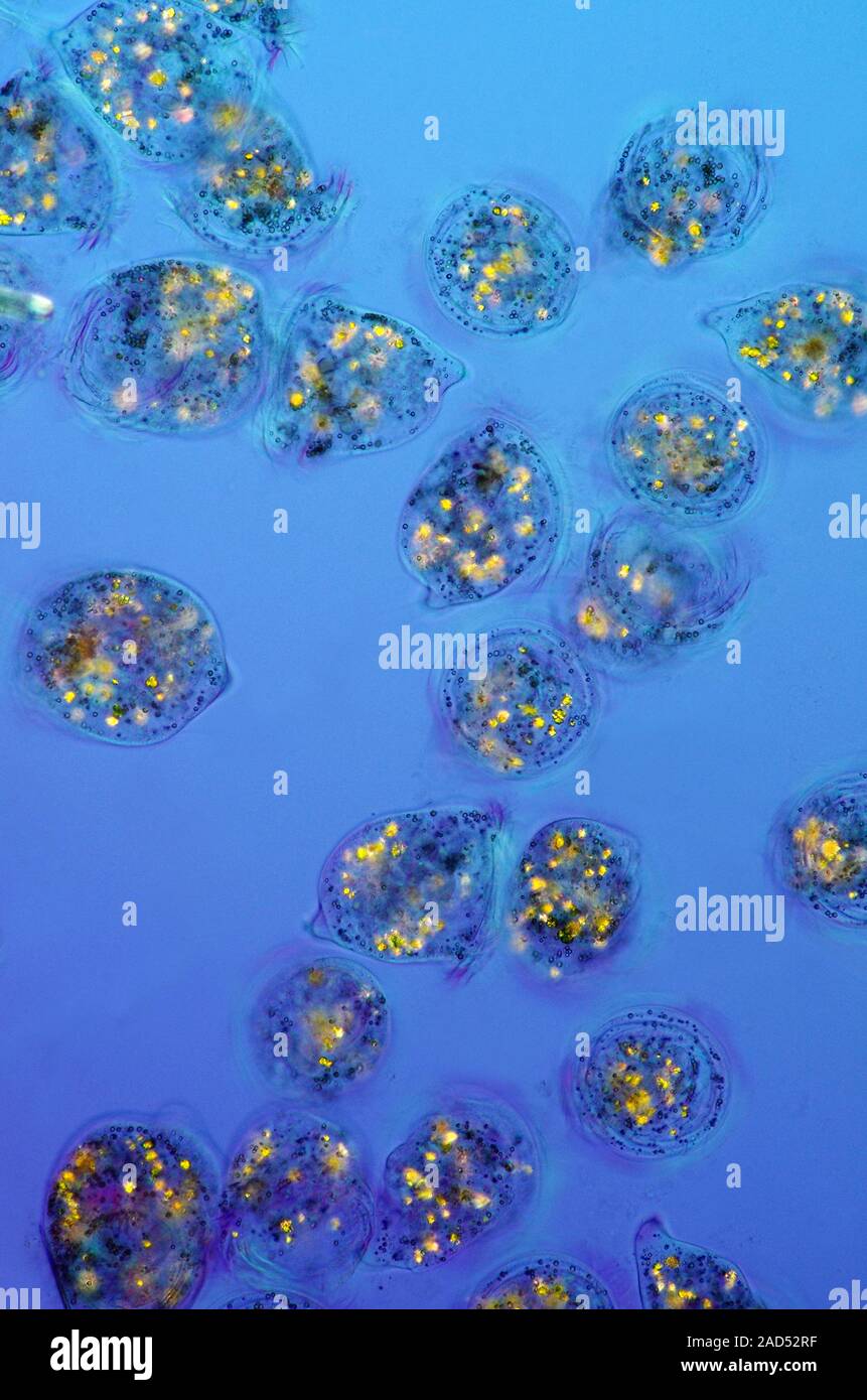 Vorticella. Polarised light micrograph of a group of Vorticella sp ...
