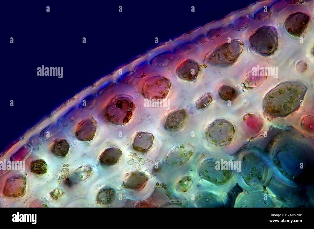 Apple stem. Polarised light micrograph of a cross section through the ...