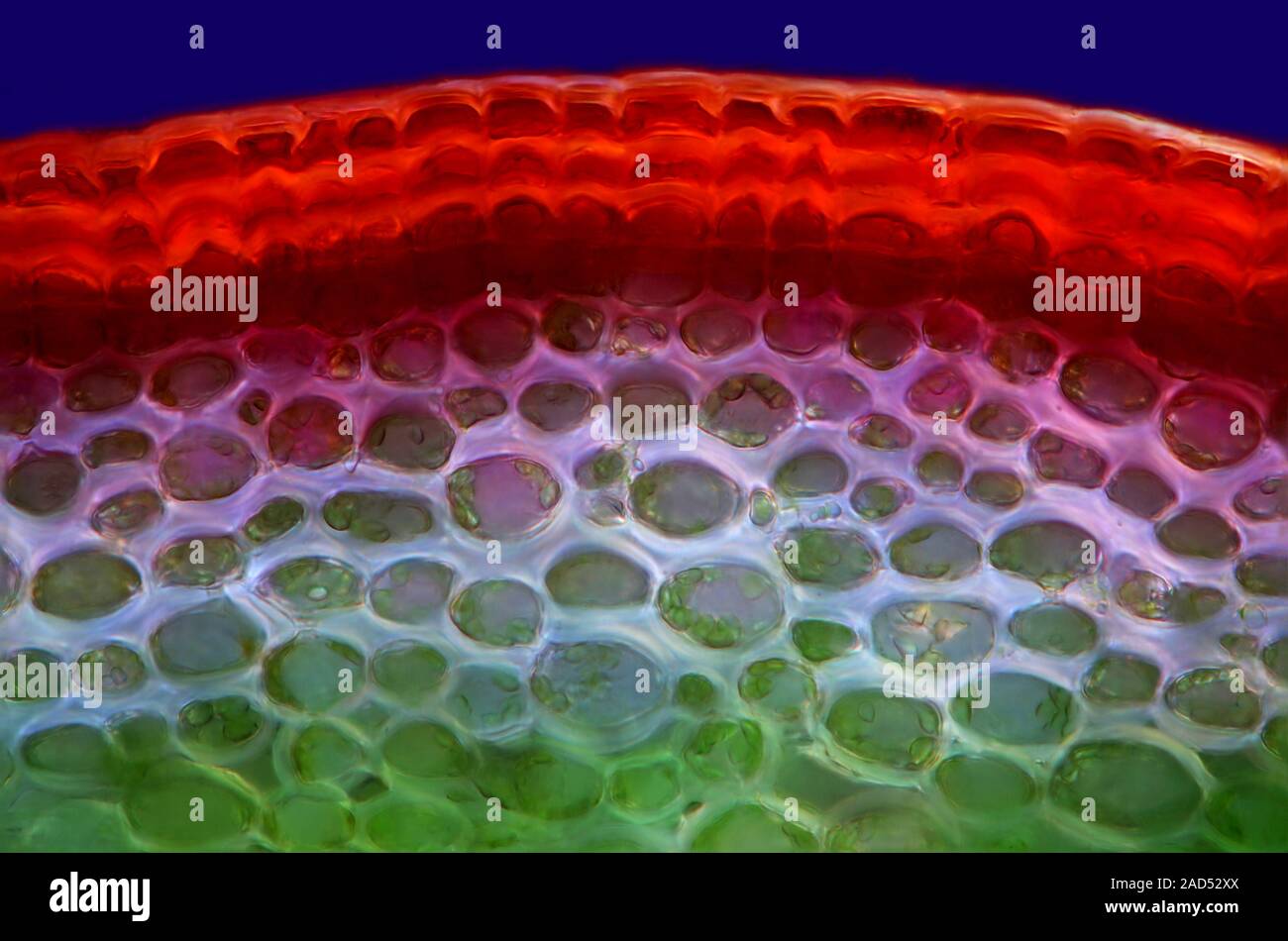 Apple stem. Polarised light micrograph of a cross section through the ...