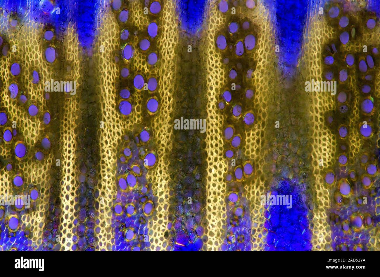 Wild cabbage stem. Polarised light micrograph of a cross section ...