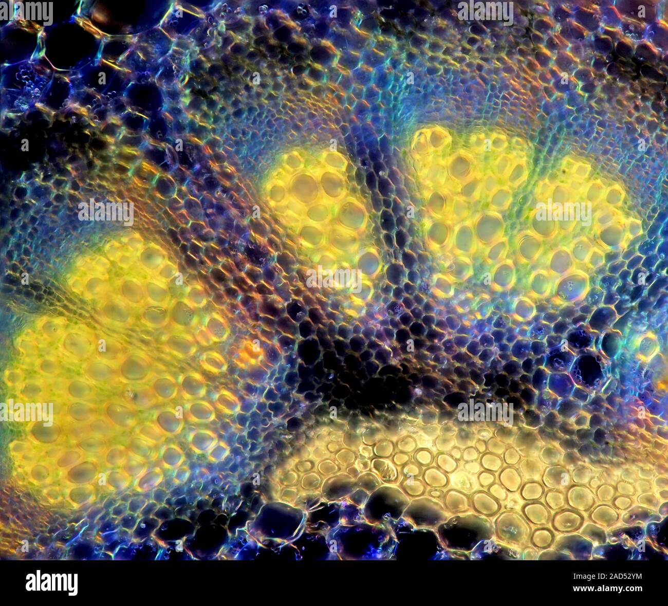 Wild cabbage stem. Darkfield illuminated polarised light micrograph of ...
