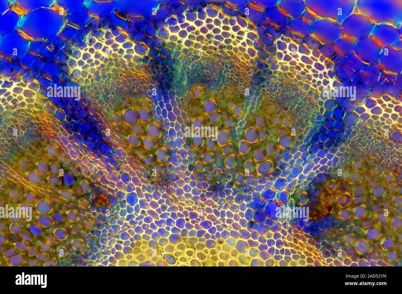Wild cabbage stem. Polarised light micrograph of a cross section ...