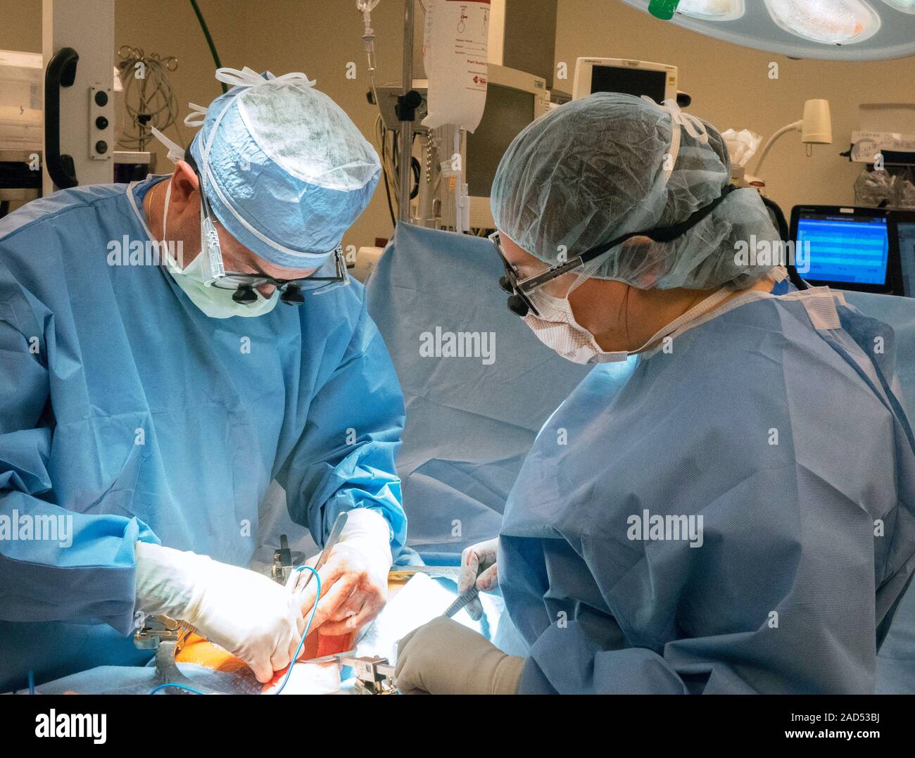 Kidney transplant surgery. Surgeons performing kidney transplant ...