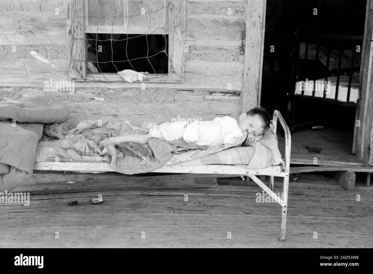 Child with spinal tuberculosis in 1939. He is in a body plaster cast ...