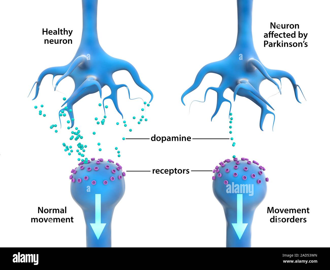 Parkinson's disease, neurons and dopamine. Illustration of the ...
