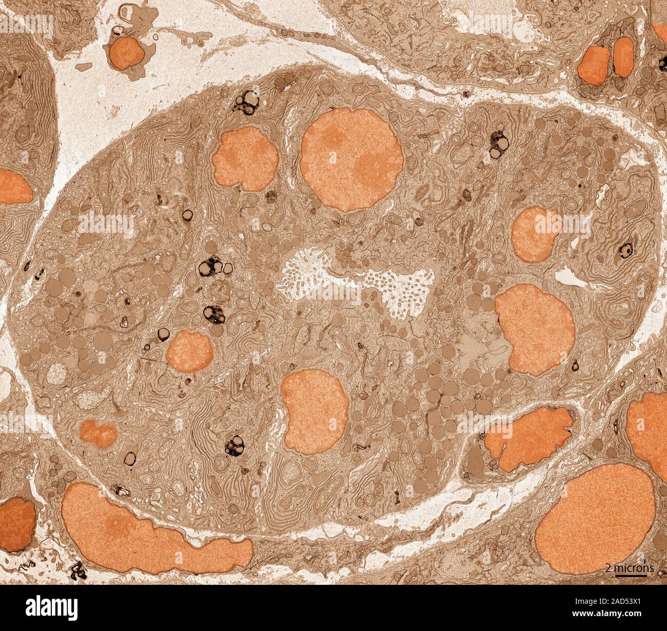 Pancreatic acinar cells, coloured transmission electron micrograph (TEM ... Pancreatic acinar cells, coloured transmission electron micrograph (TEM ...