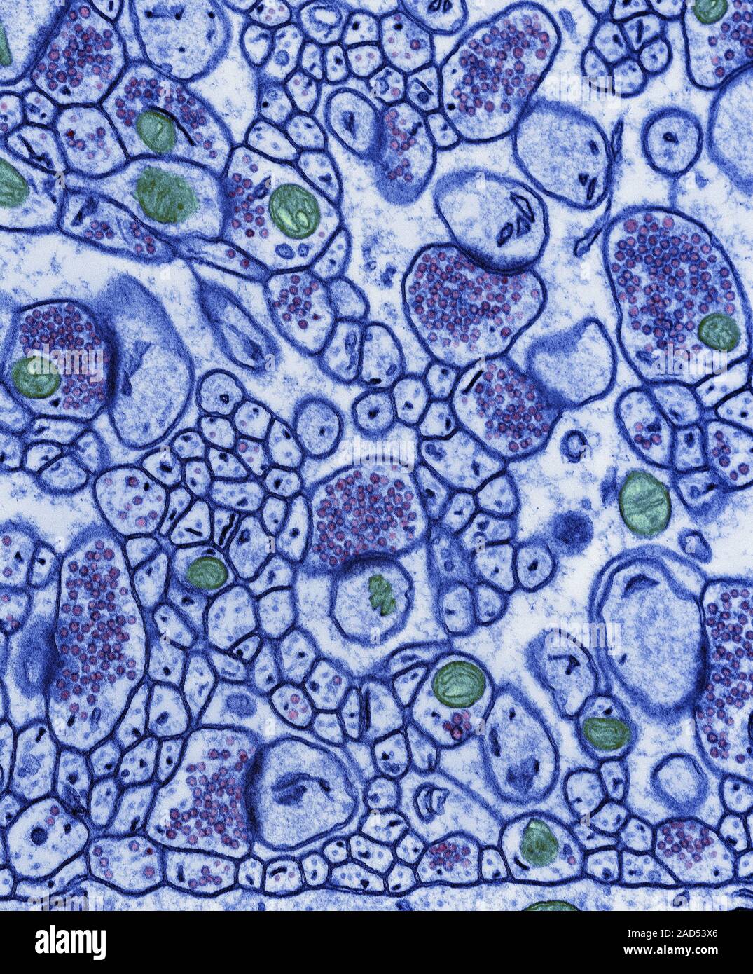 Synapses in cerebellum, coloured transmission electron micrograph (TEM ...