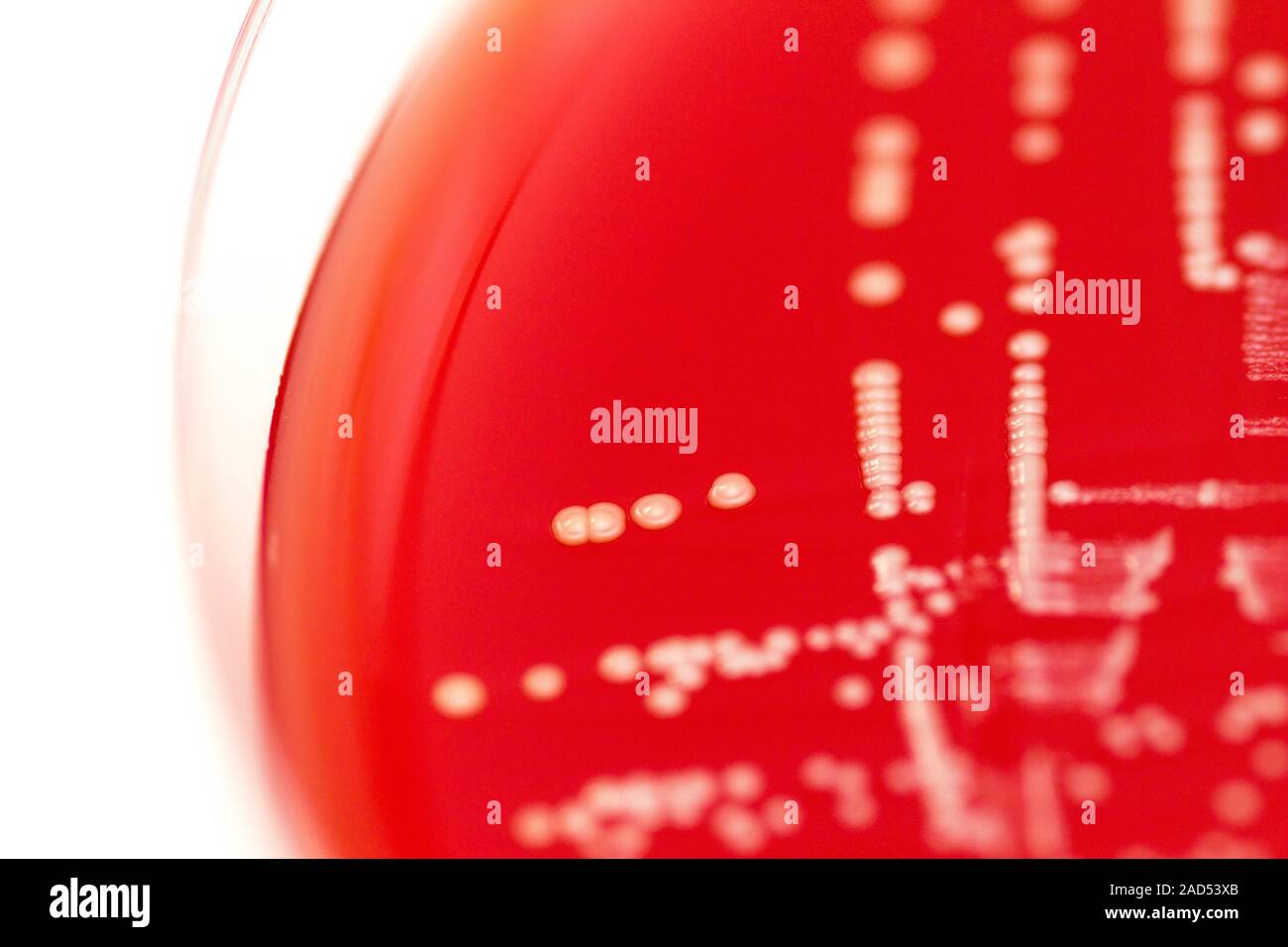 Corynebacterium renale culture on blood agar. Corynebacterium renale is ...