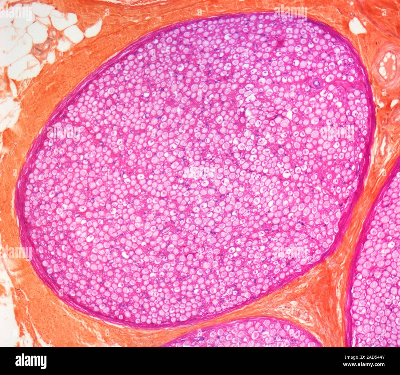 Nerve fibres. Light micrograph (LM) of a transverse section through a ...