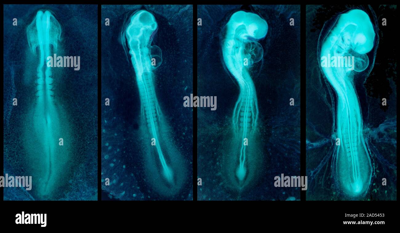 Chick development. Light micrograph (LM) of a sequence of normal chick ...