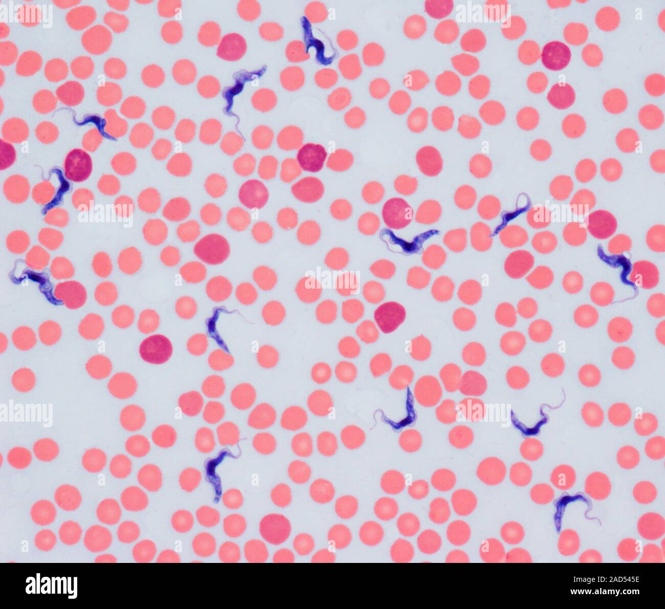 Trypanosoma. Light micrograph (LM) of blood infected with the parasitic ...