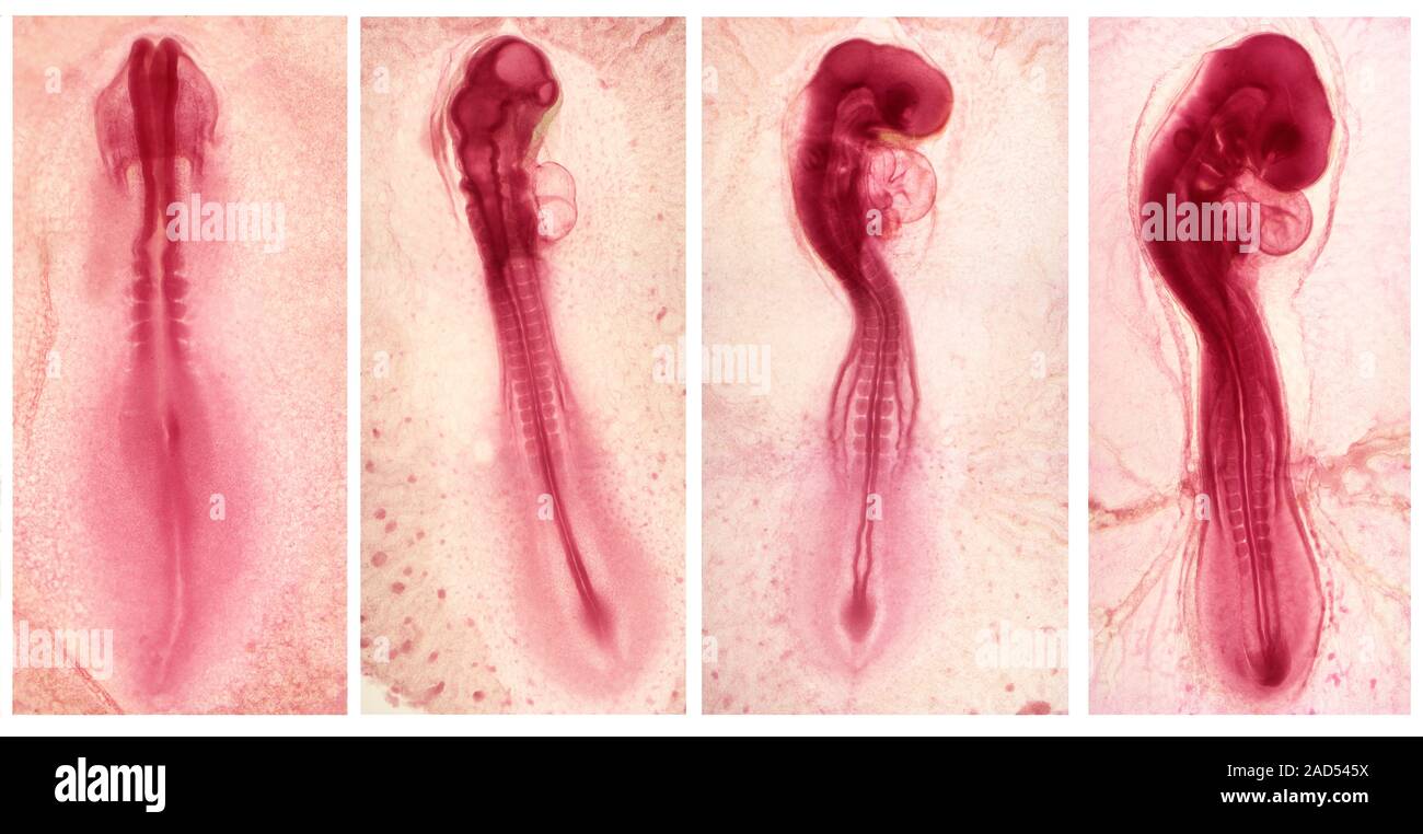 Chick development. Light micrograph (LM) of a sequence of normal chick ...