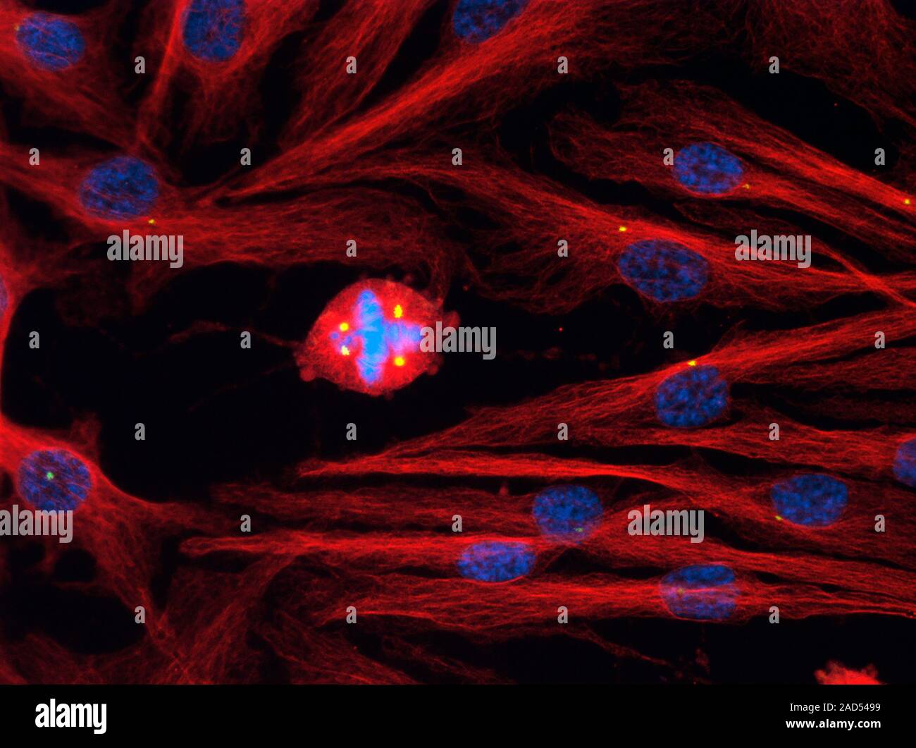 Cancerous epithelial cell dividing. Fluorescence light micrograph of a ...