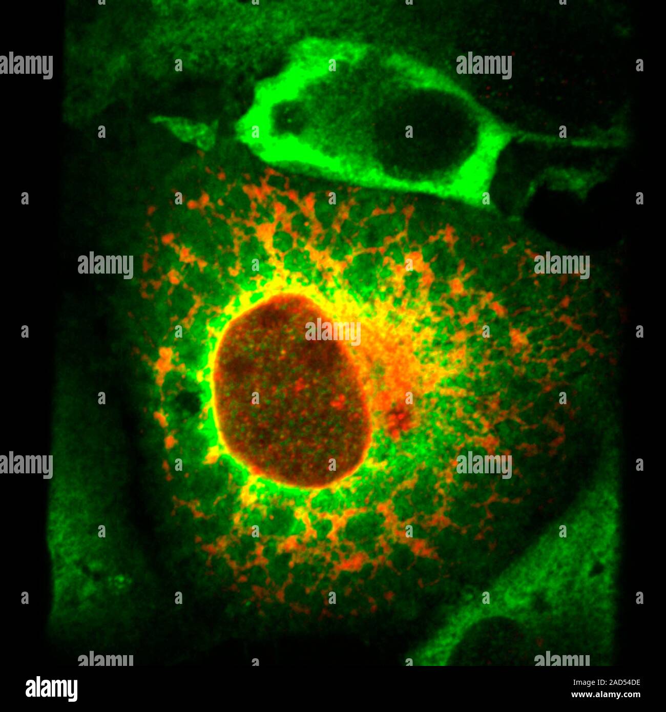 Human papillomavirus cancer research. Fluorescence light micrograph of ...
