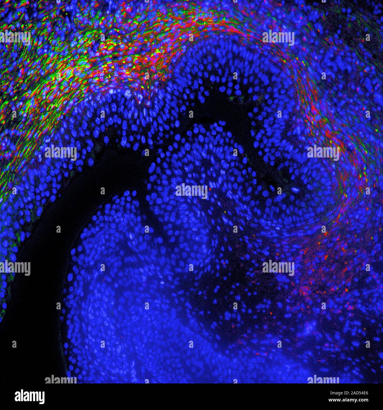 Bladder cancer treatment research. Fluorescence light micrograph of ...