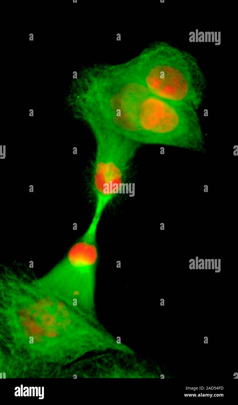 Cells dividing. Fluorescence light micrograph of cells dividing. The ...