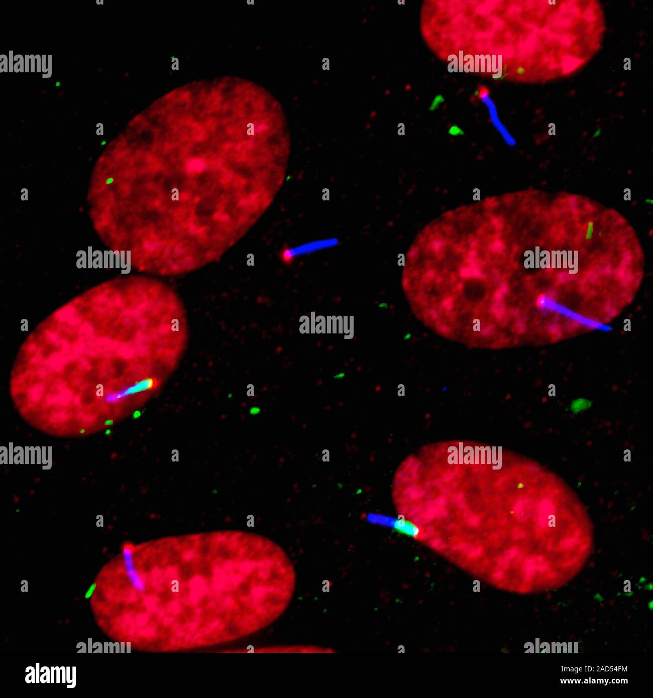 Cilia-based cancer treatment research. Fluorescence light micrograph of ...
