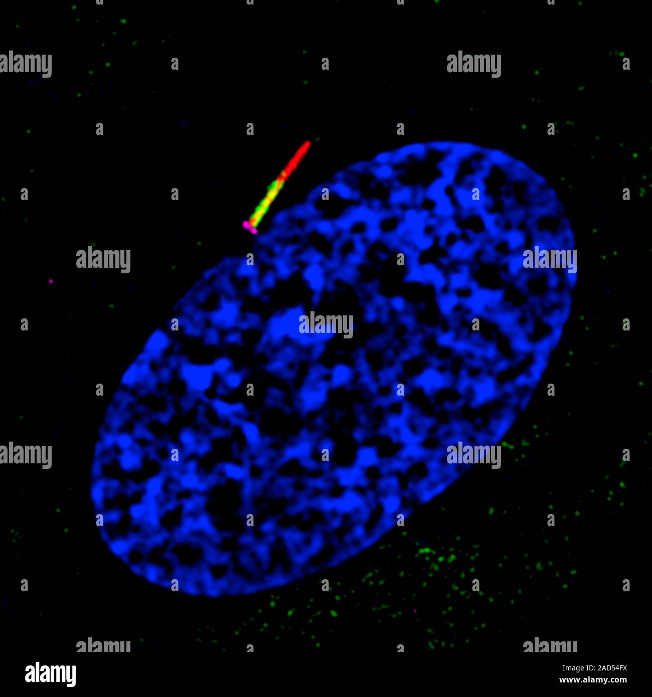 Cilia-based cancer treatment research. Structured illumination ...