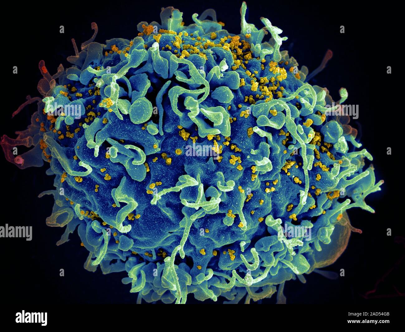 T cell under attack by HIV. Coloured scanning electron micrograph (SEM ...