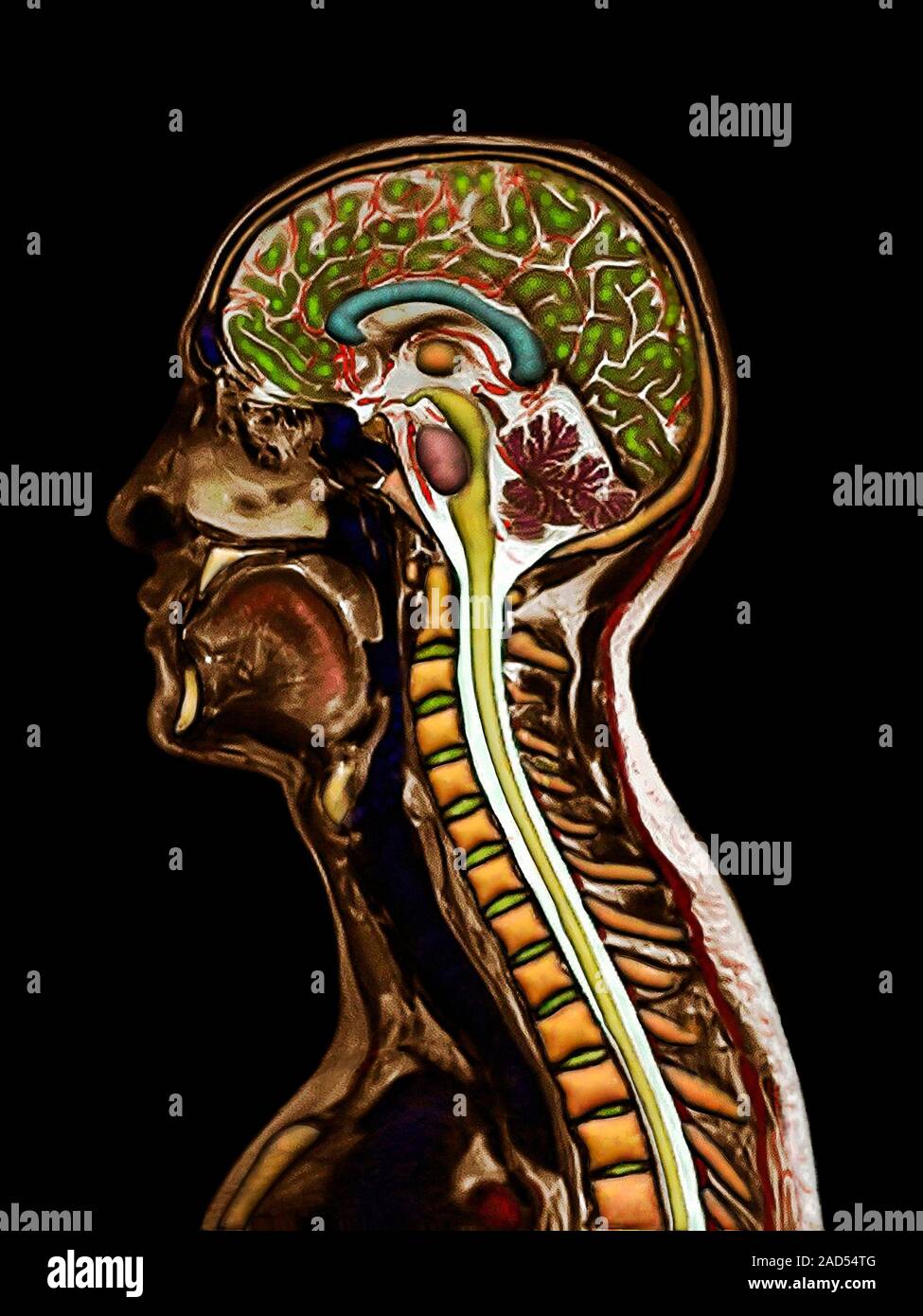 Head and neck. Colour-converted sagittal magnetic resonance imaging ...