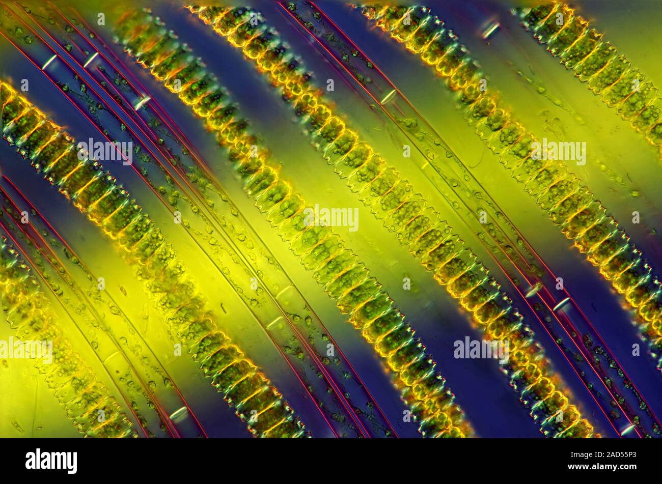 Desmids and Spirogyra algae. Polarised light micrograph of colonies of ...