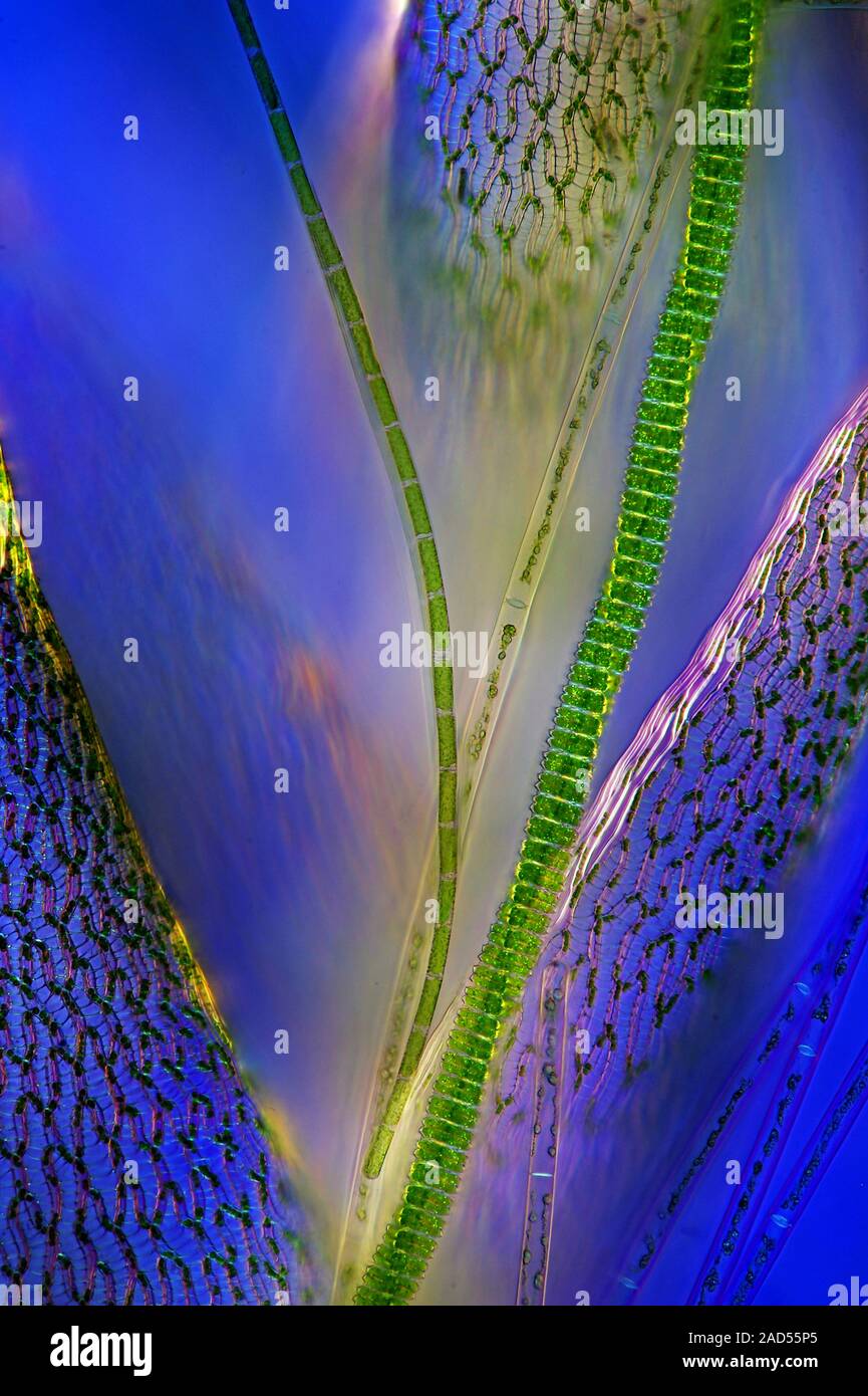Green algae and sphagnum moss. Polarised light micrograph of colonies ...