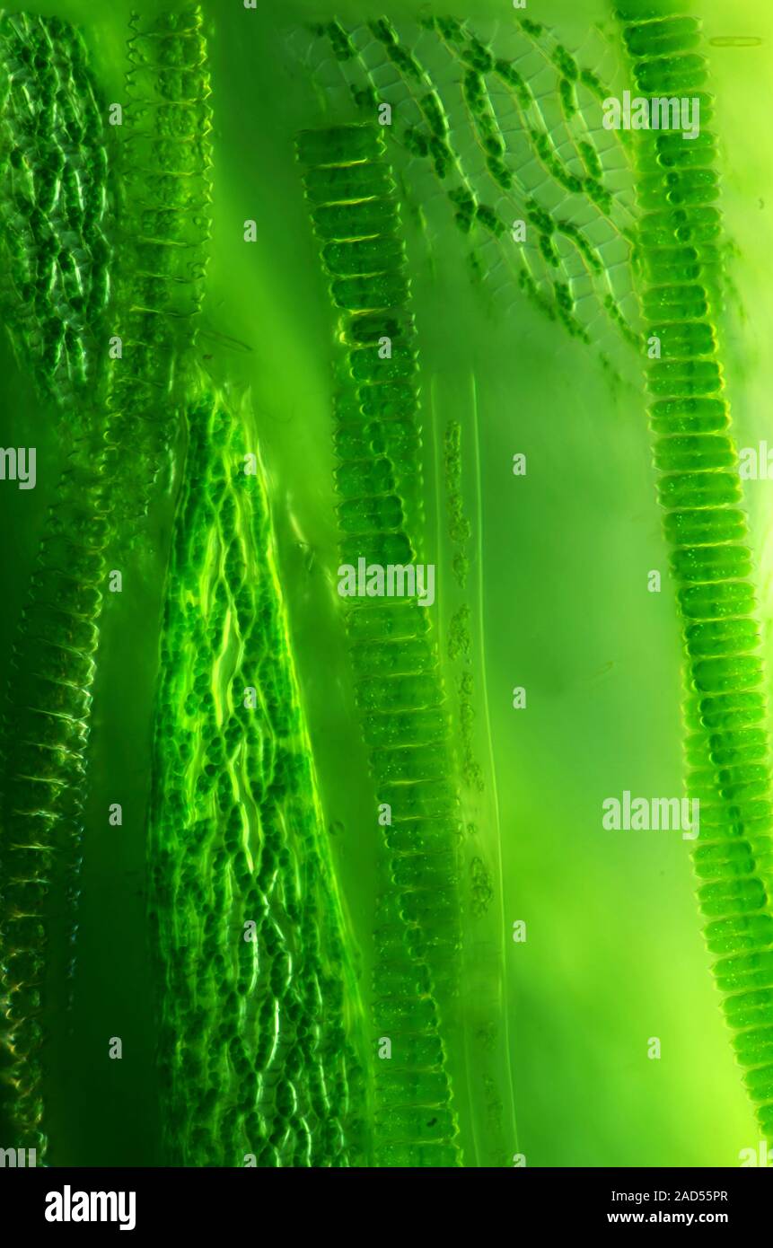 Desmids and sphagnum moss. Darkfield illuminated polarised light ...