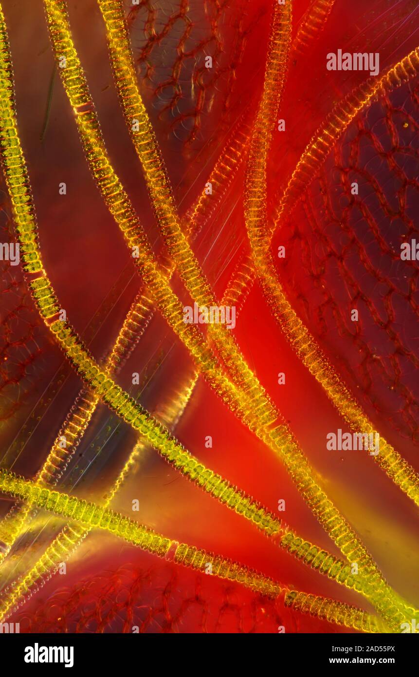 Desmids and sphagnum moss. Polarised light micrograph of colonies of ...