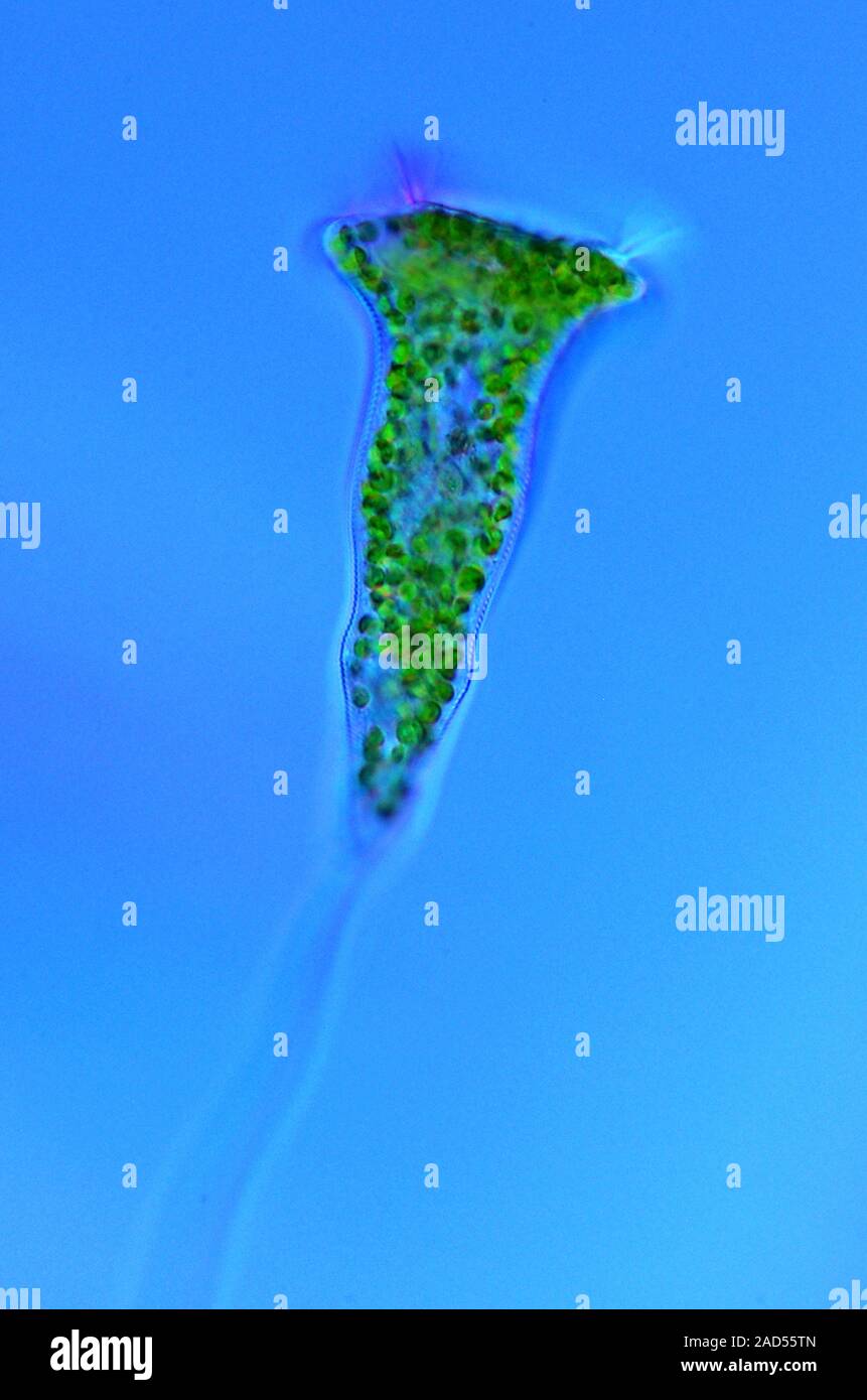 Vorticella protozoan. Polarised light micrograph of a Vorticella sp ... Vorticella protozoan. Polarised light micrograph of a Vorticella sp ...
