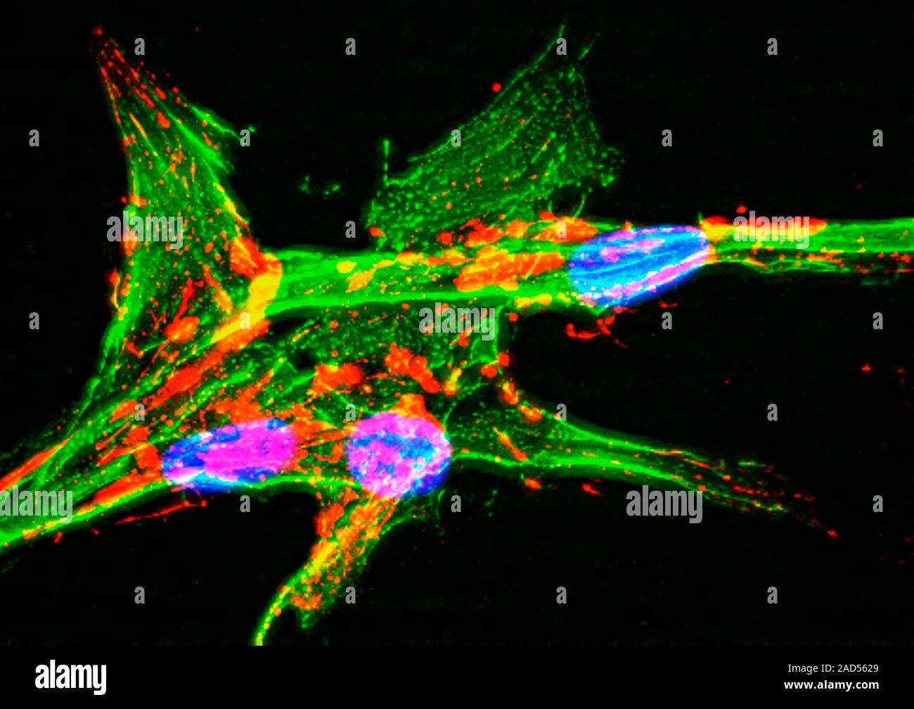 Astrocyte brain cells, fluorescence light micrograph. This study shows ...