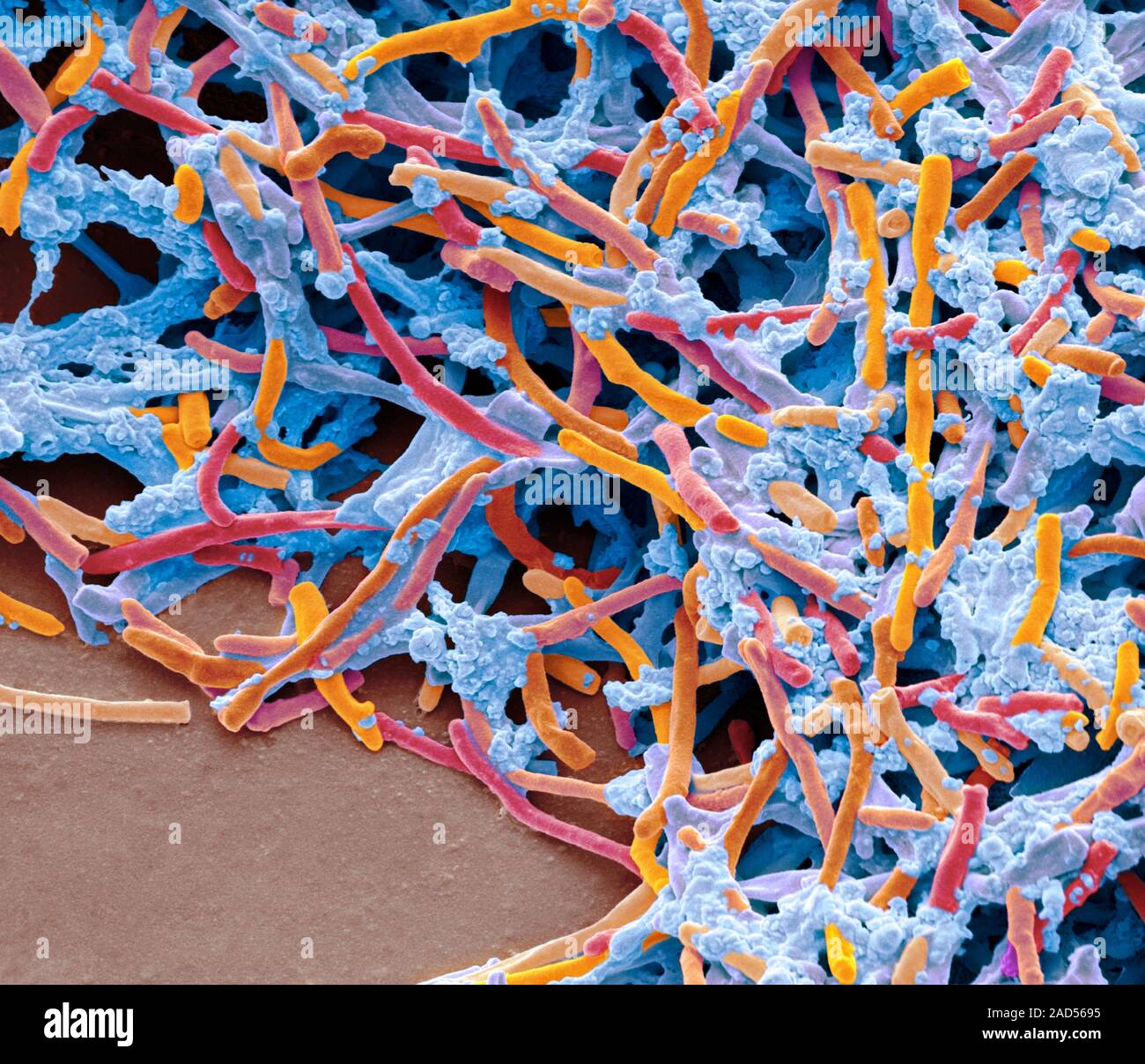 Actinomycosis Scanning Electron Micrograph Sem From A Patient With Pelvic Actinomycosis