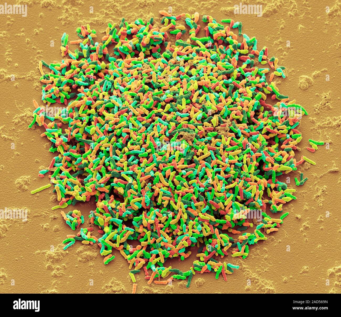 Bacterial colony. Scanning electron micrograph (SEM) of a bacterial ... Bacterial colony. Scanning electron micrograph (SEM) of a bacterial ...