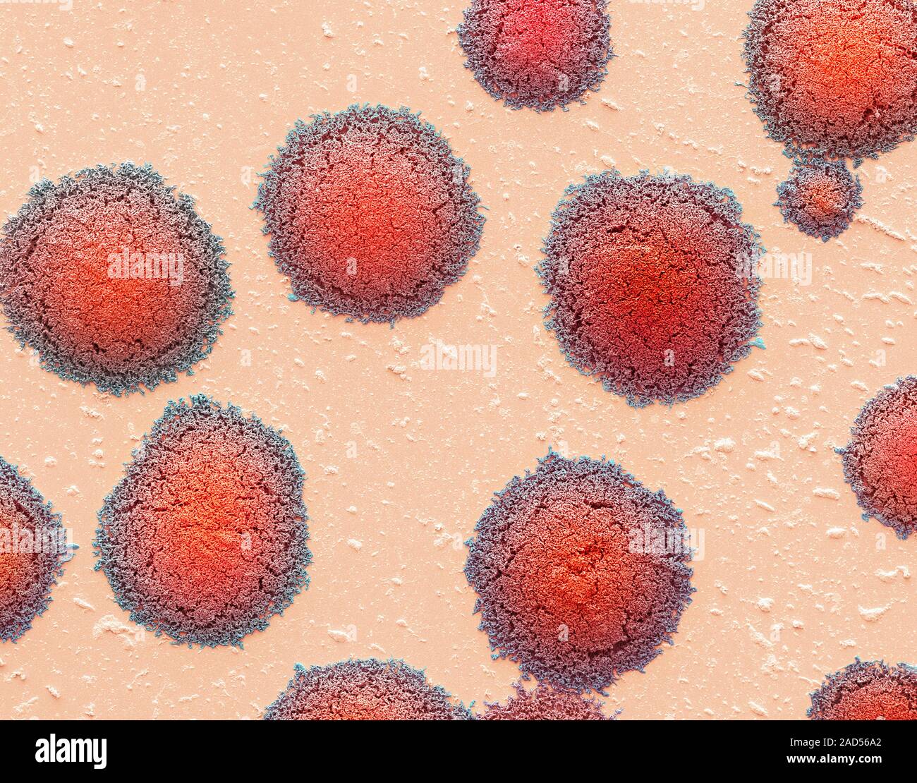 Bacterial colonies. Scanning electron micrograph (SEM) of a bacterial ... Bacterial colonies. Scanning electron micrograph (SEM) of a bacterial ...