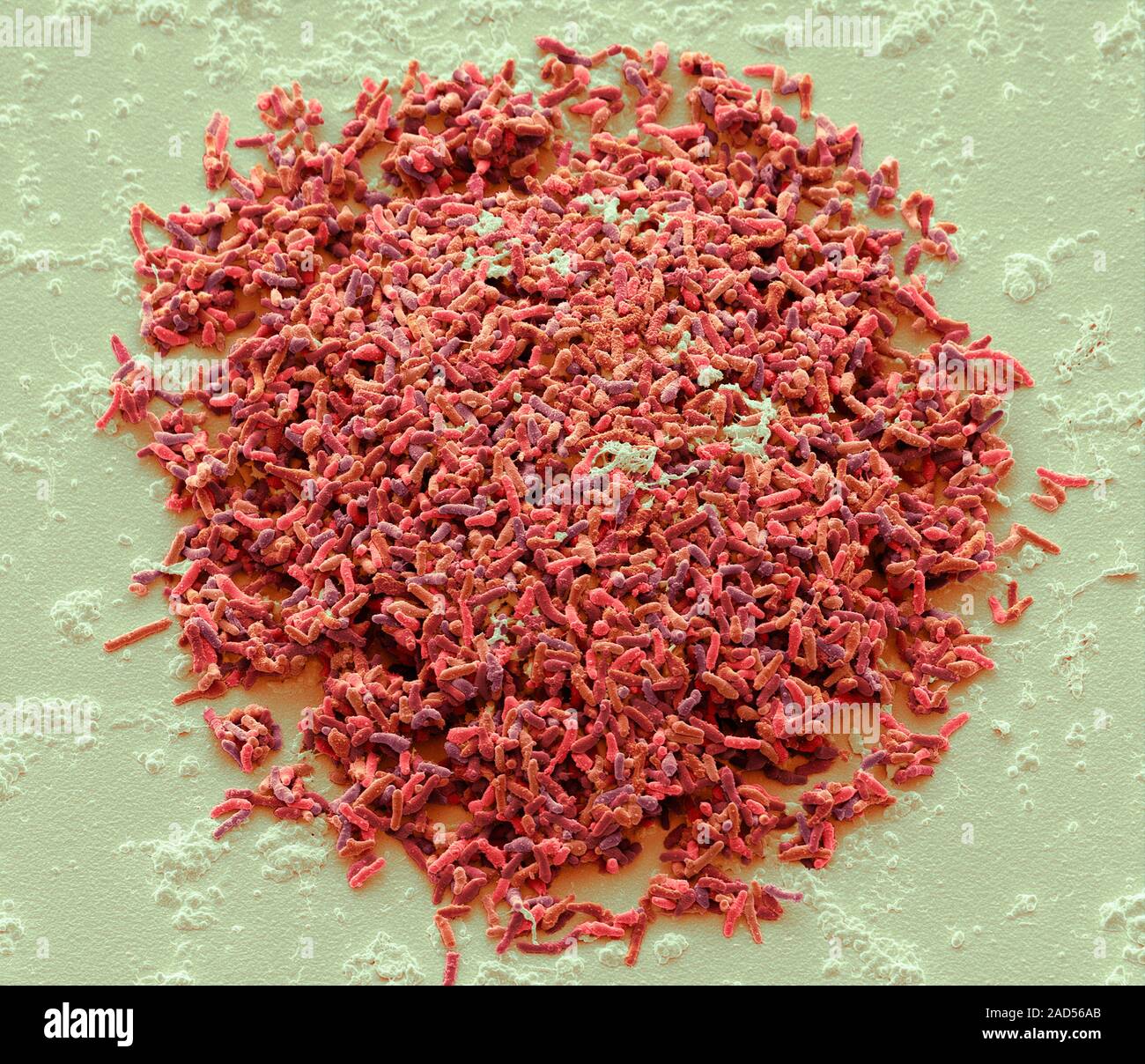 Bacterial colony. Scanning electron micrograph (SEM) of a bacterial ... Bacterial colony. Scanning electron micrograph (SEM) of a bacterial ...