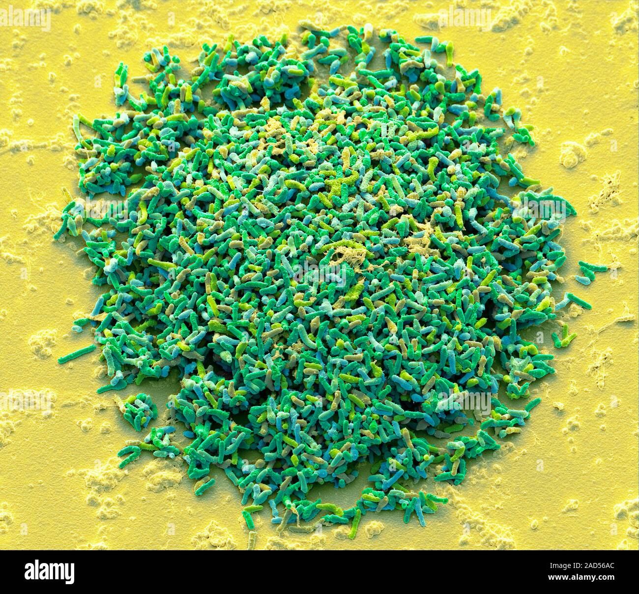 Bacterial colony. Scanning electron micrograph (SEM) of a bacterial ... Bacterial colony. Scanning electron micrograph (SEM) of a bacterial ...