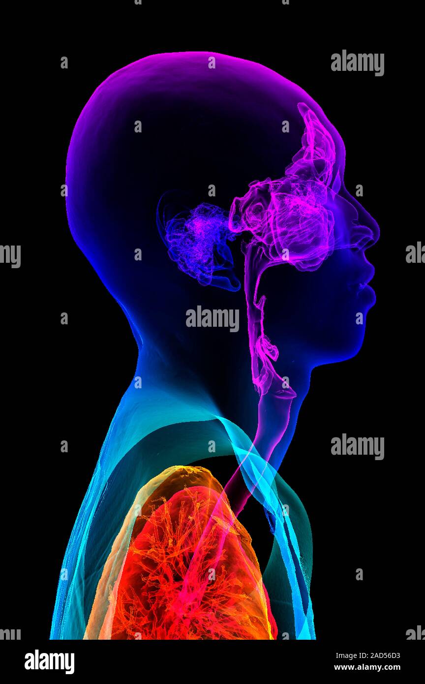 Human airways. Coloured 3D computed tomography (CT) scan of the head ...