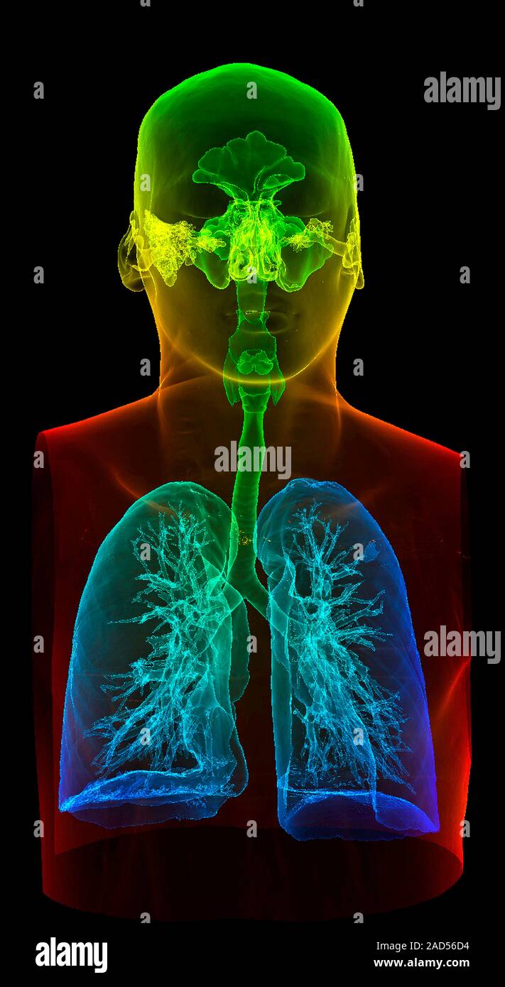 Human airways. Coloured 3D computed tomography (CT) scan of the head ...