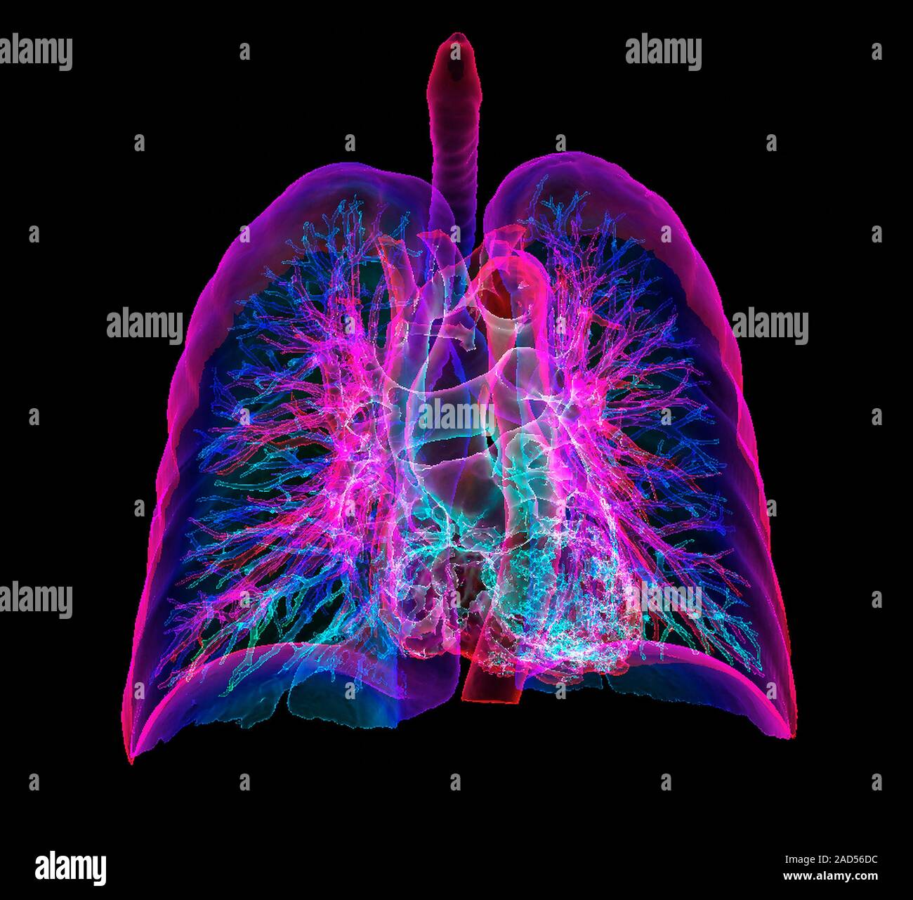 Human heart and lungs. Coloured 3D computed tomography (CT) scan of ...