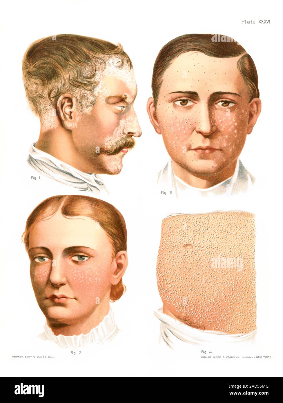 Skin disorders. Historical medical illustration showing skin disorders ...