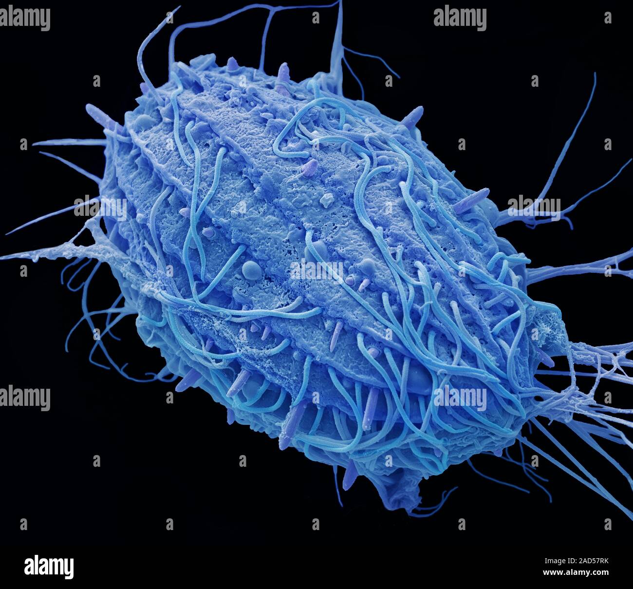 Marine ciliate protozoan. Scanning electron micrograph (SEM) of a ...