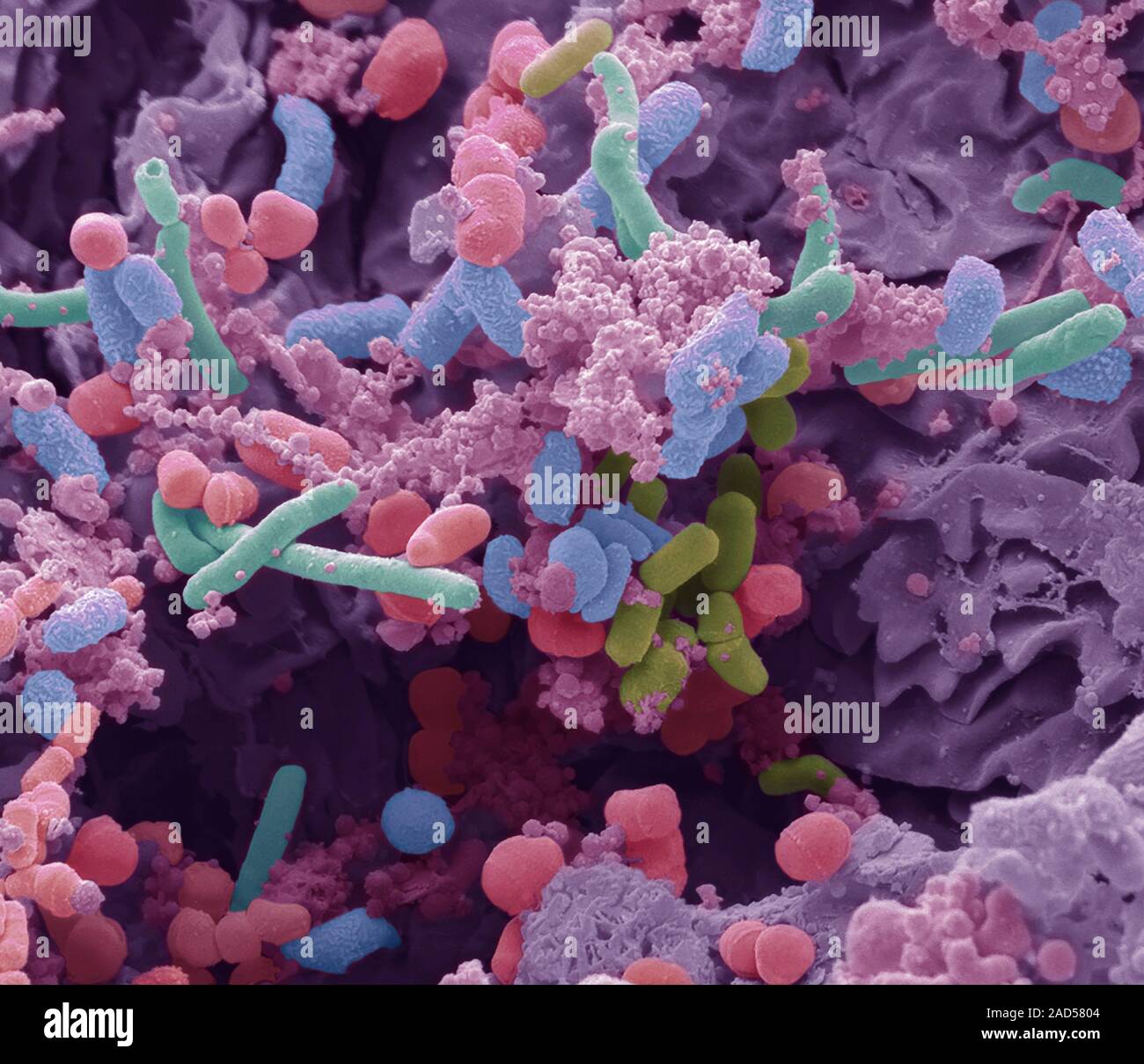 Bacterial skin infection. Coloured scanning electron micrograph (SEM ...