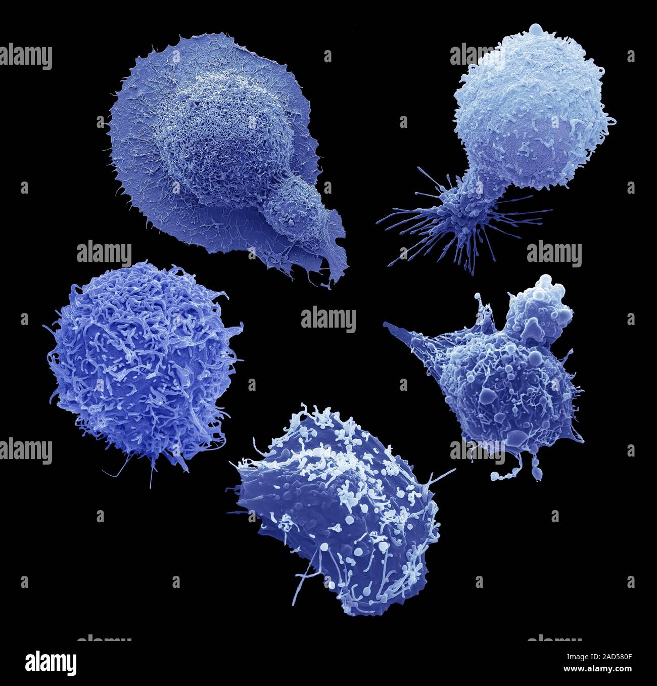 Male cancers. Coloured scanning electron micrograph (SEM) of cells from ...