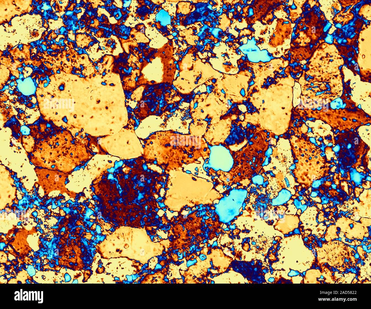 Polarised light micrograph of a thin section of ganister.A ganister is ...