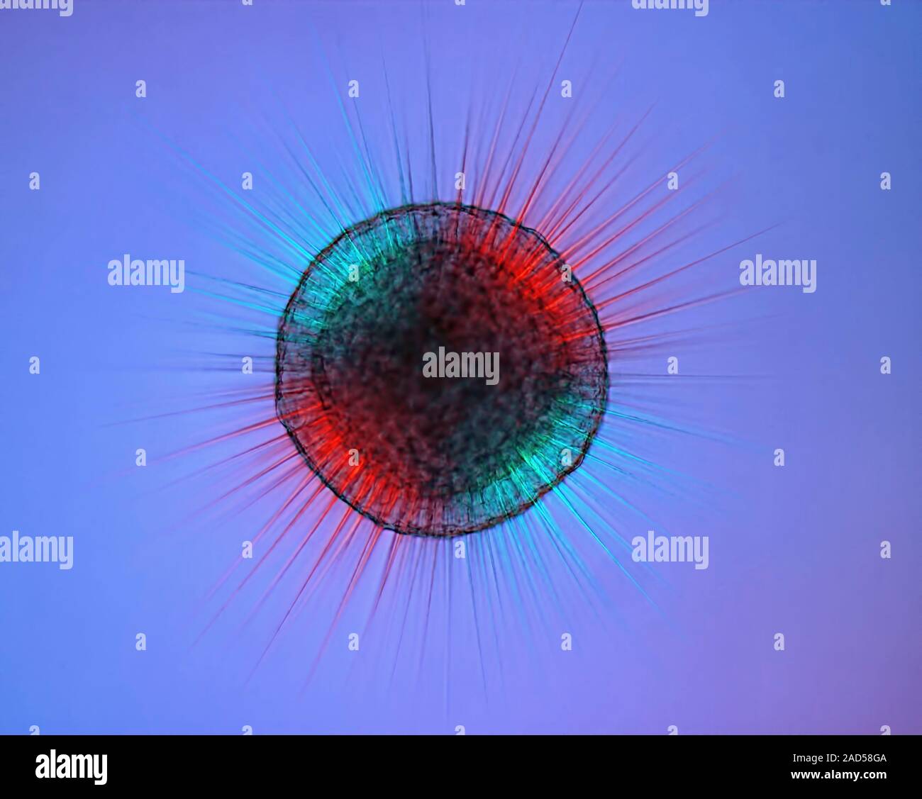 Actinosphaerium heliozoan. Polarised light micrograph of an ...
