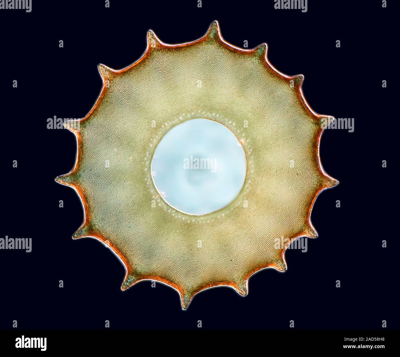Shelled amoeba. Polarised light micrograph of an Arcella sp. testate ...