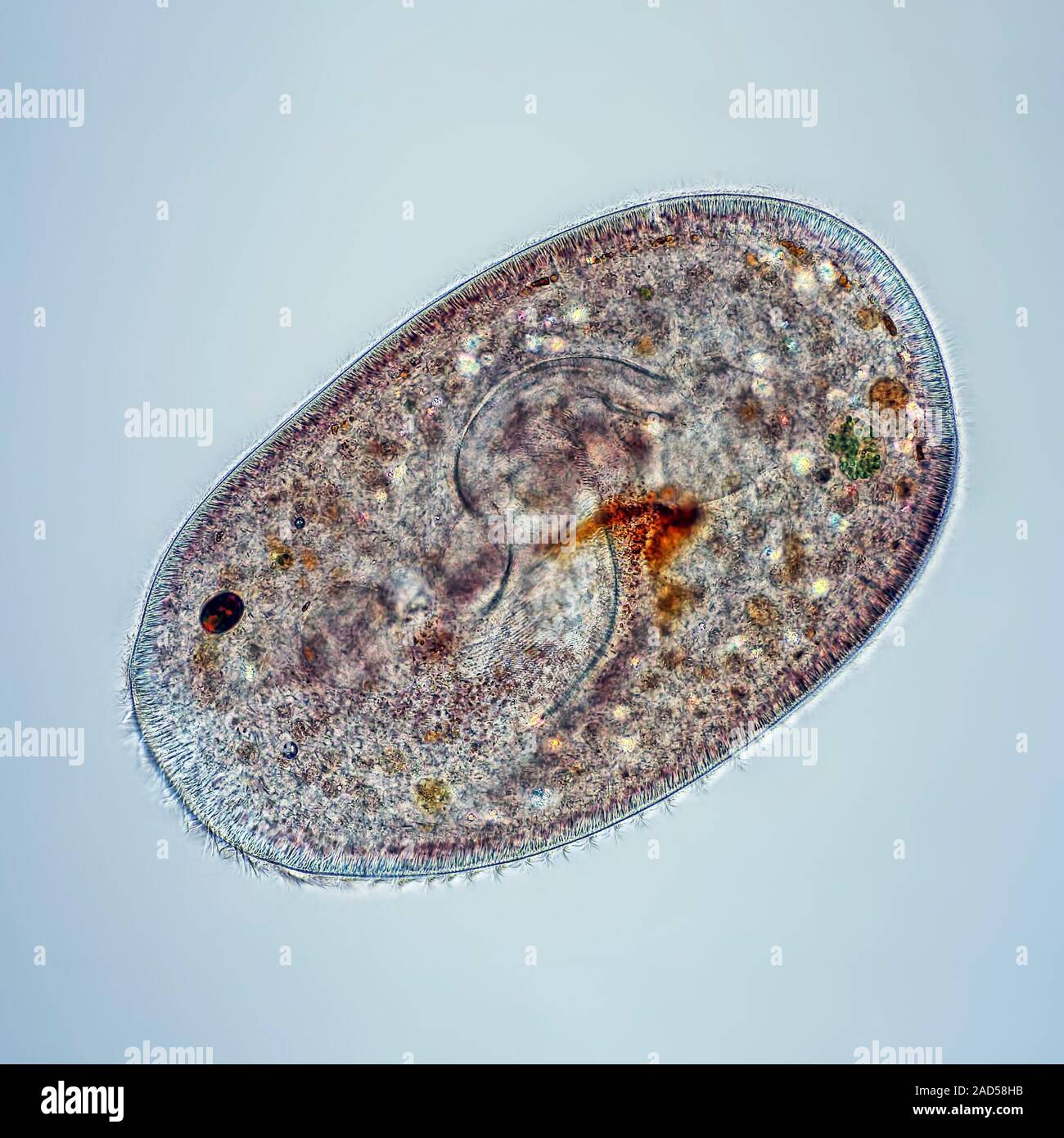 Bursaria protozoan. Polarised light micrograph of a freshwater ciliate ...