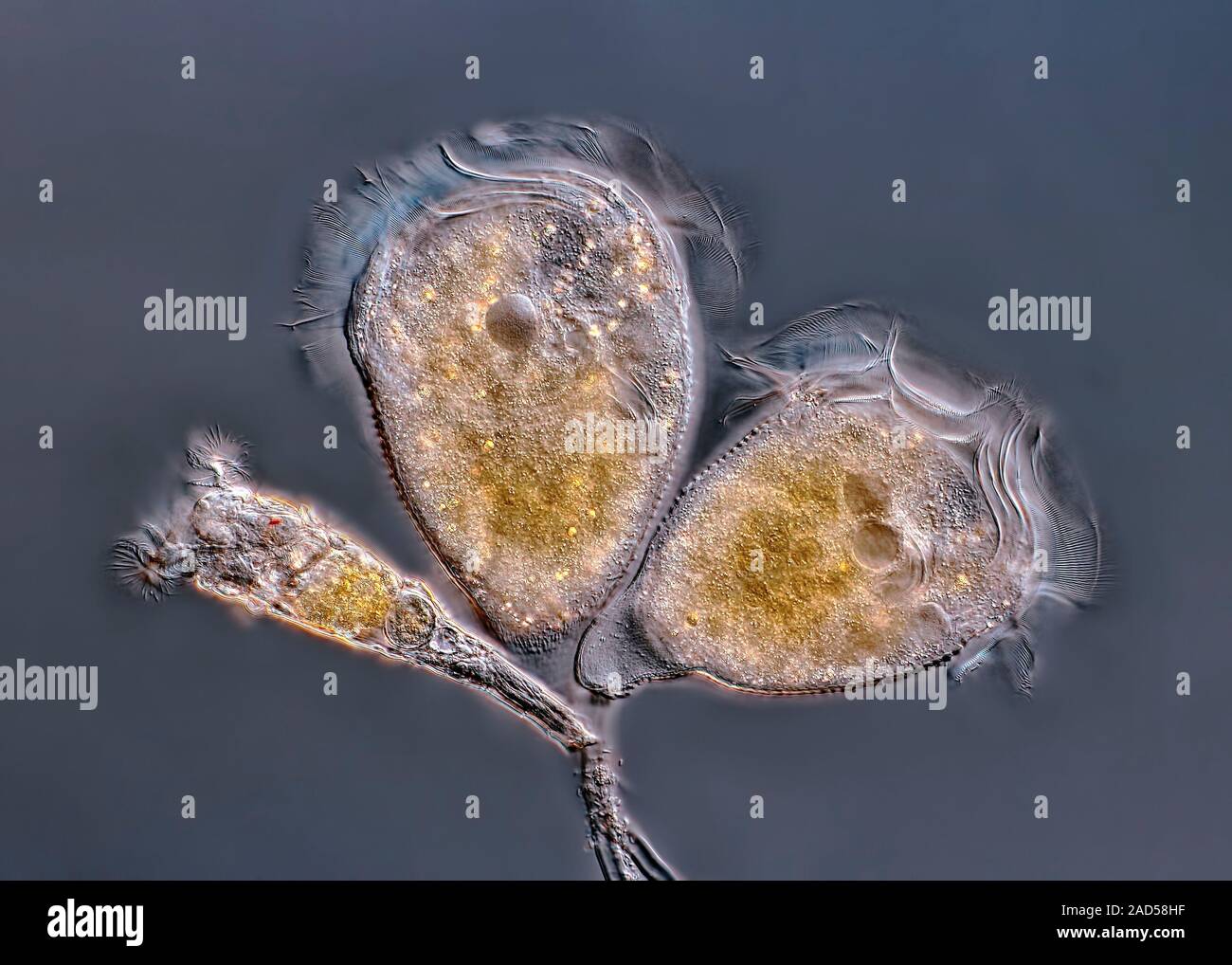 Campanella protozoa. Light micrograph of several ciliate protozoa of ...