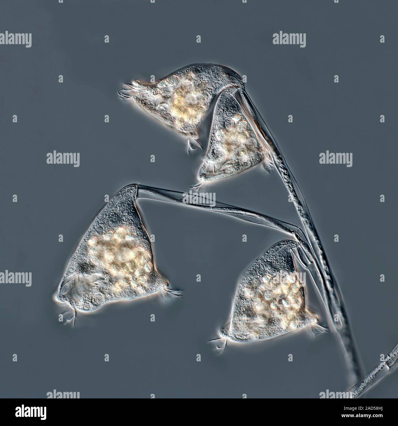 Carchesium colony. Light micrograph of a colony of Carchesium sp ...