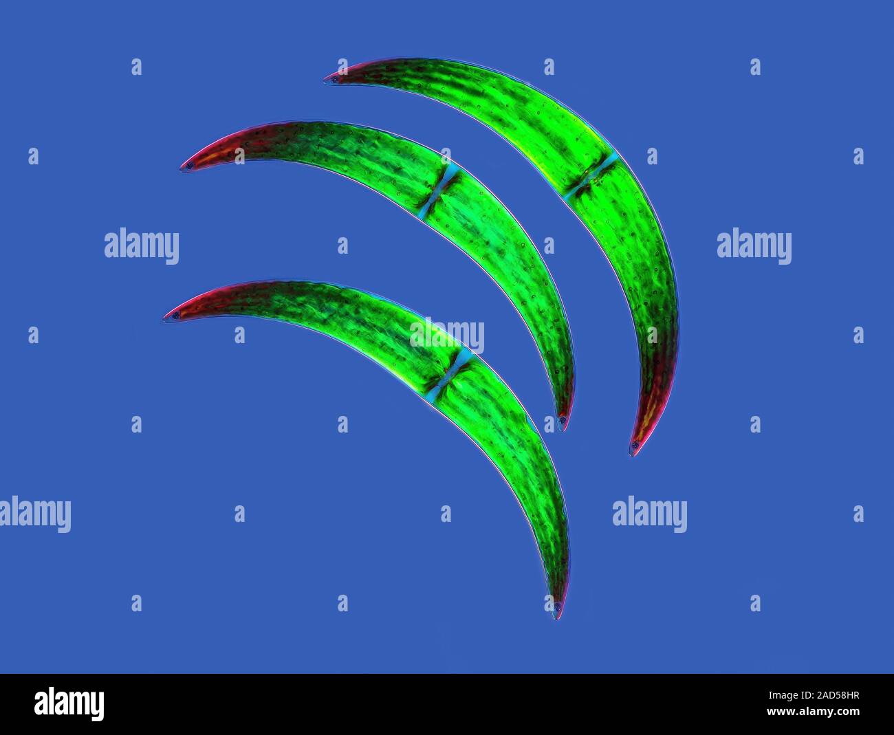 Closterium desmids. Polarised light micrograph of three Closterium sp ...