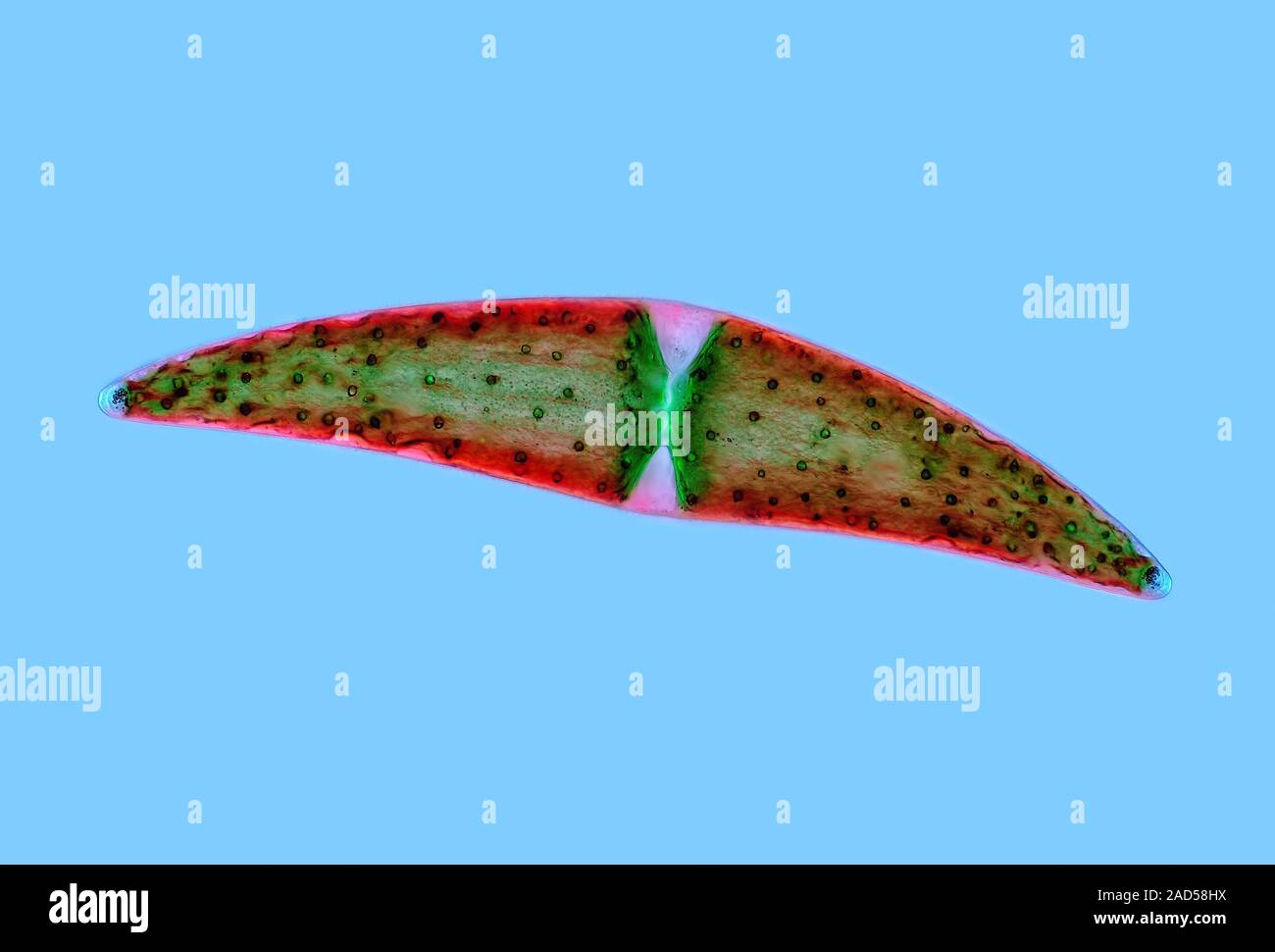Closterium desmid. Polarised light micrograph of a Closterium sp ...